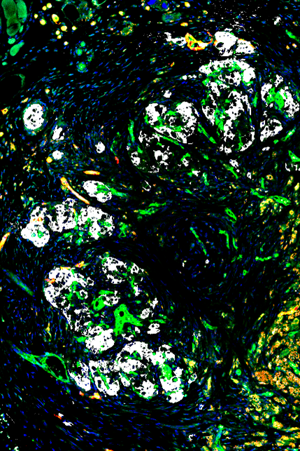 Students, Faculty, and Staff Research and Interests – Bronx Community ...